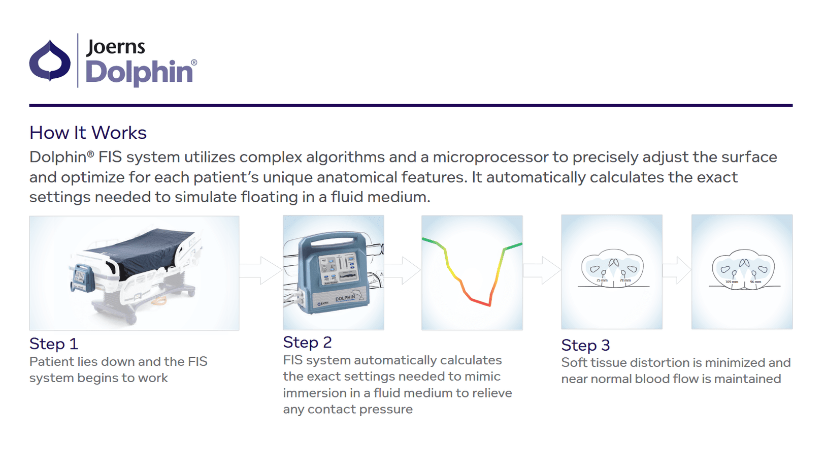 Joerns Dolphin® Fluid Immersion Simulation® Therapy Mattress System